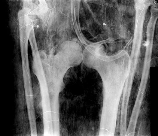 Afterlife: Missing Bones - The Australian Museum Blog