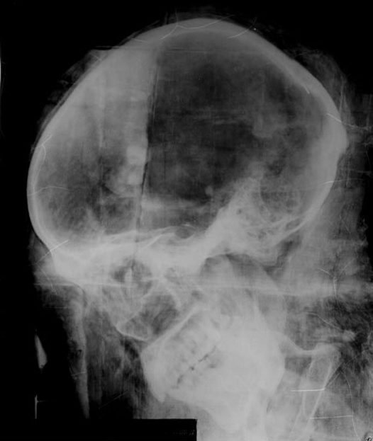 Afterlife: Embalming the Egyptian Way - The Australian Museum Blog