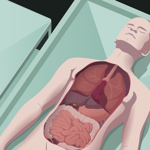 Virtual autopsy - The Australian Museum